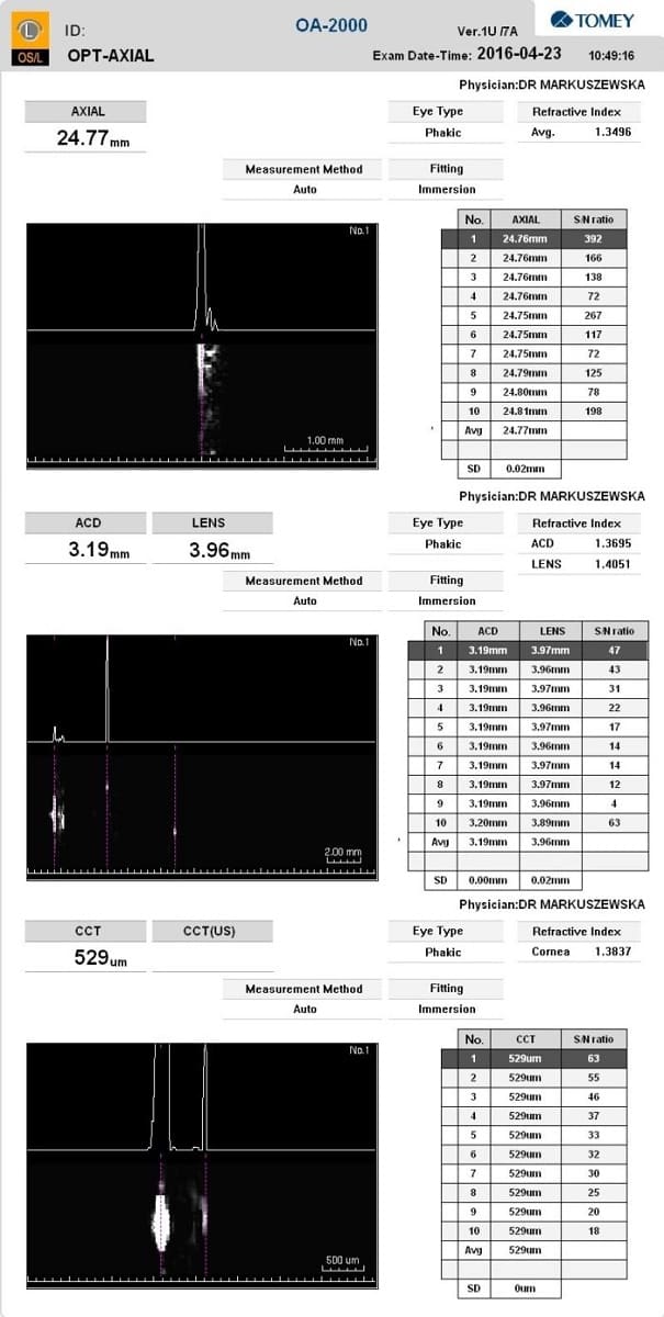 Biometria optyczna oka Wrocław | wco.com.pl
